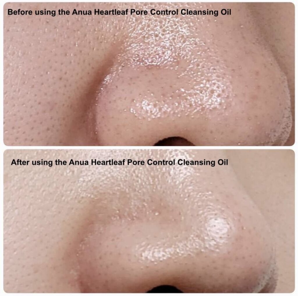 Anua – Hearleaf Pore Control Cleansing Oil – Chok Chok